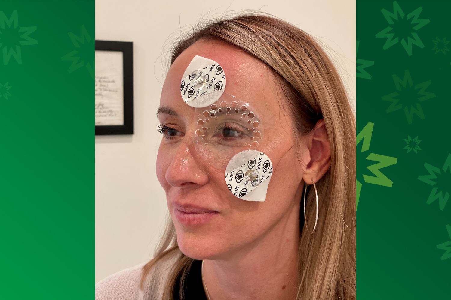 SNAPS Eyeshield has been awarded Ophthalmology Products agreement with ...